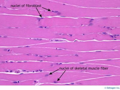 Skeletal Muscle Slide Labeled How Does The Appearance Smooth Of Muscle