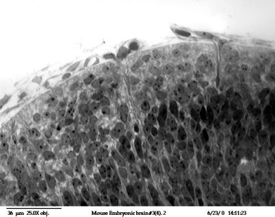 Mouse Embryo Brain - Mouse embryo brain #3(4)2