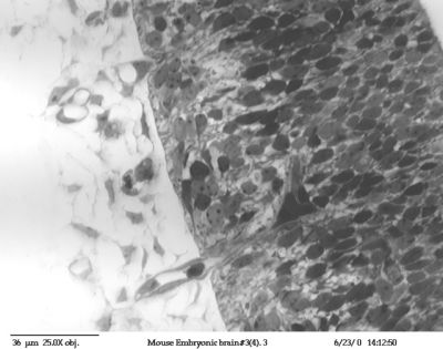 Mouse Embryo Brain - Mouse embryo brain #3(4)3