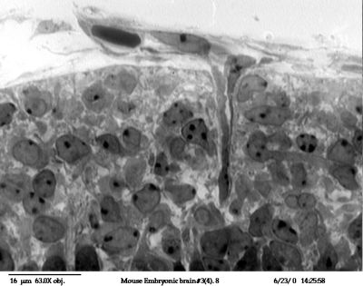 Mouse Embryo Brain - Mouse embryo brain #3(4)8